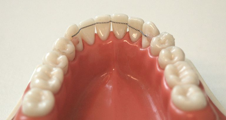 Dr. Safavi / KFO auf der Geest - Retainer